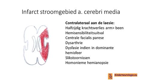 Behandeling Herseninfarct Kinderneurologie