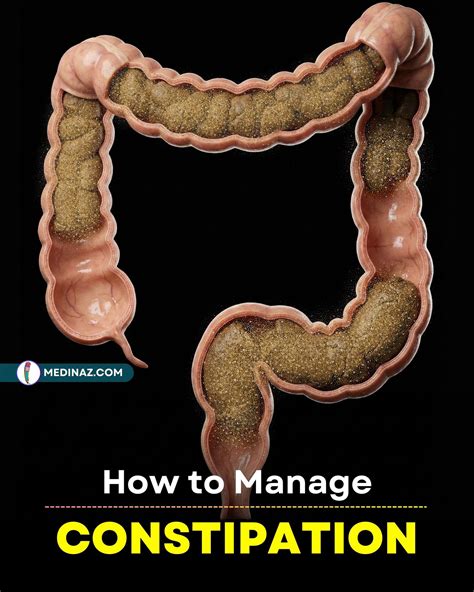 Medinaz ️ Constipation Management Constipation Means Having Hard