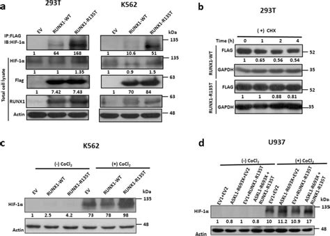 Runx1 Mutations Promote Leukemogenesis Of Myeloid Malignancies In Asxl1 Mutated Leukemia Pmc