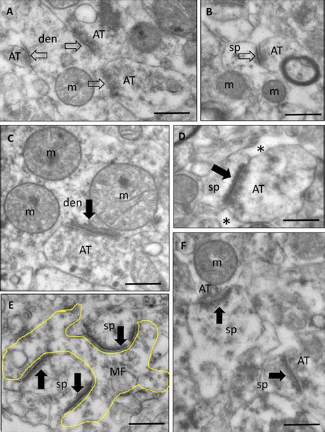 Electron Micrographs Showing Synaptic Types In Different Regions Download Scientific Diagram