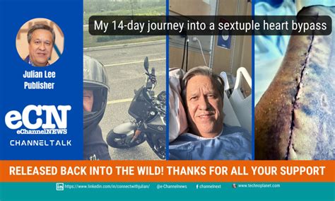 Im Back After A Sextuple Heart Bypass E