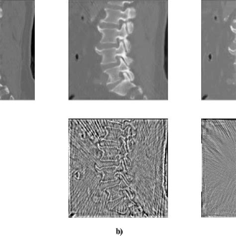 Feature Extraction Method For Synthetic Aperture Radar Sar Data Download Scientific Diagram
