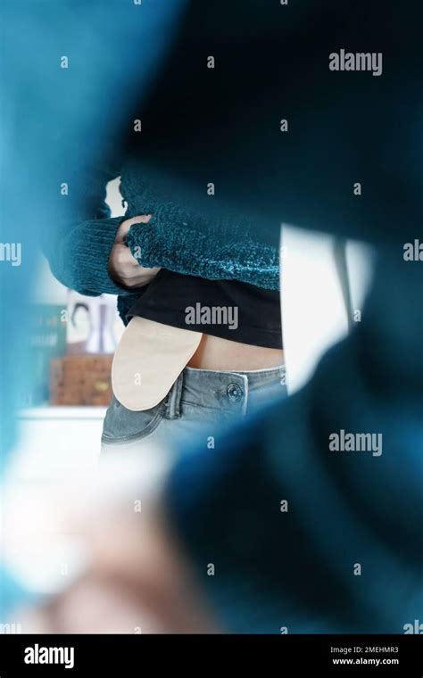 A Female Colon Cancer Survivor Looking At The Ostomy Bag In The Mirror