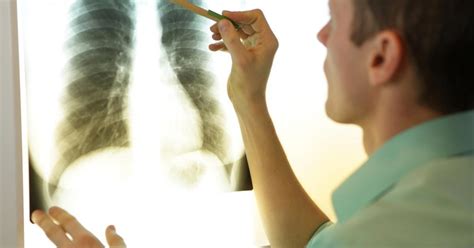 What Is The Xiphoid Process