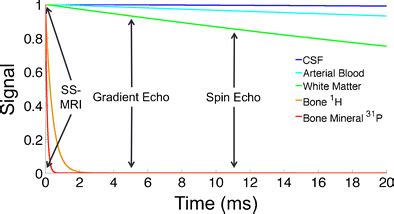 Plot of the signal decay curves for several tissue types Both ¹H and Download Scientific
