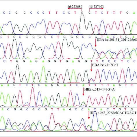 Sanger Sequencing Verification Results Of 5 Novel Mutations A Download Scientific Diagram