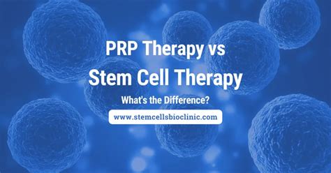 Prp Therapy Vs Stem Cell Therapy Whats The Difference