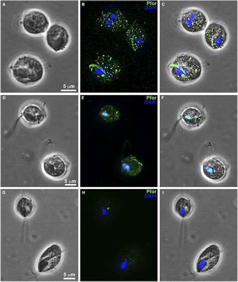 Trichomonas Vaginalis Under Microscope