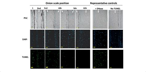 Detection Of Dna Fragmentation In Cross Sections Of Successive Scales