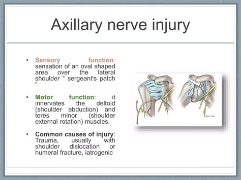 Peripheral Nerve Injuries Pptx