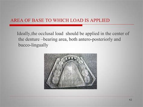 Designing For Kennedy Class I And Class Ii Ppt Oral Care Personal Care