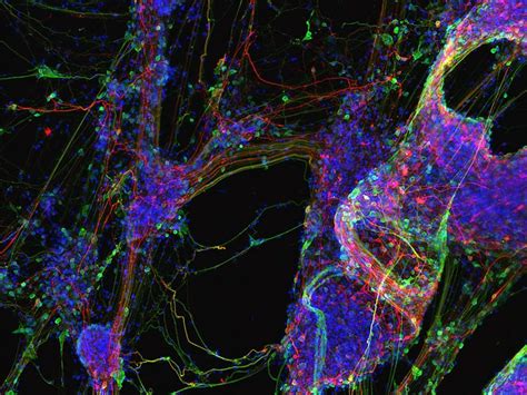 Fluorescence Microscopy Explained A Beginners Guide Keyence America