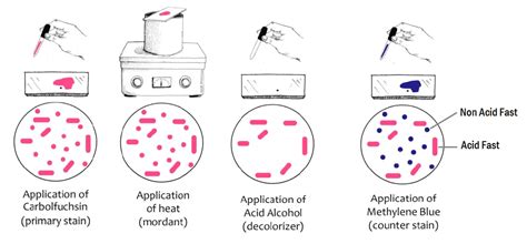 😂 Acid Fast Stain Lab Report Lessons From A Proficiency Testing Event For Acid 2019 01 15