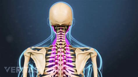 Stiff Neck Causes Symptoms And Treatment