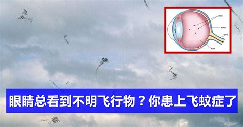 了解什么是飞蚊症