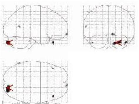 Maximum Intensity Projection Of Normalized Images Activated By Music2 Download Scientific Diagram