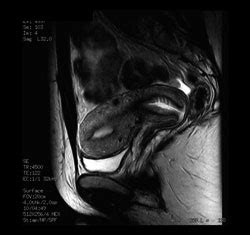 Mri Mri