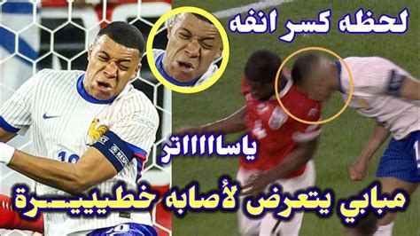 لحظه اصابة كيليان مبابي وكســر انفه😱لقطة مميــتة وخطيــرة Youtube