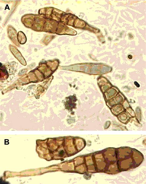 Epidemic Asthma And The Role Of The Fungal Mold Alternaria Alternata