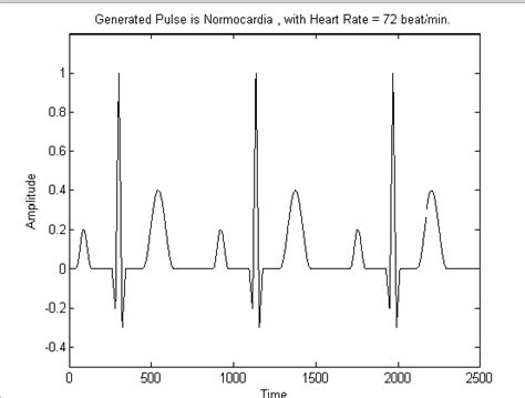Figure 1 From Arrhythmia Detection Using Wavelet Transform Semantic Scholar