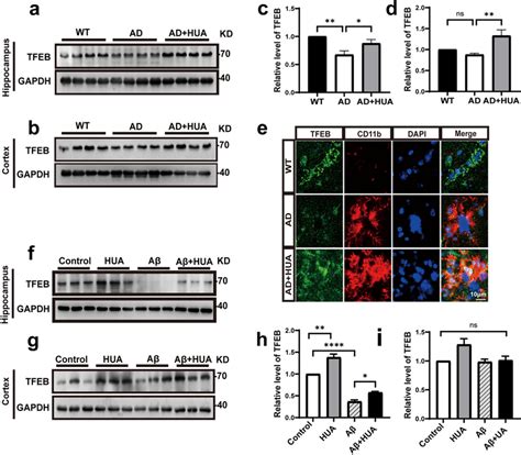 Ua Promoted The Expression Of Tfeb In Ad Mice Model Of Aβ Induced Mice Download Scientific