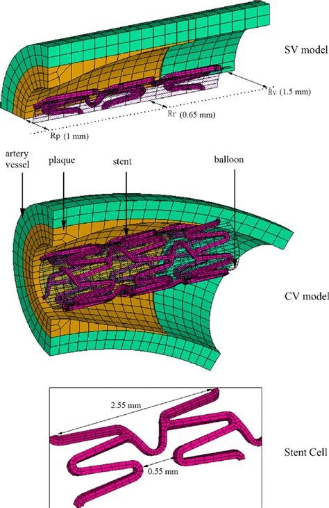 Finite Element Models Of The Sv And Cv Model The Stent Is Our Patent Download Scientific