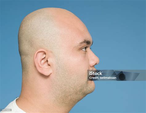 측면 보기 대머리 머리가 빠지다에 대한 스톡 사진 및 기타 이미지 머리가 빠지다 옆모습 남자 Istock