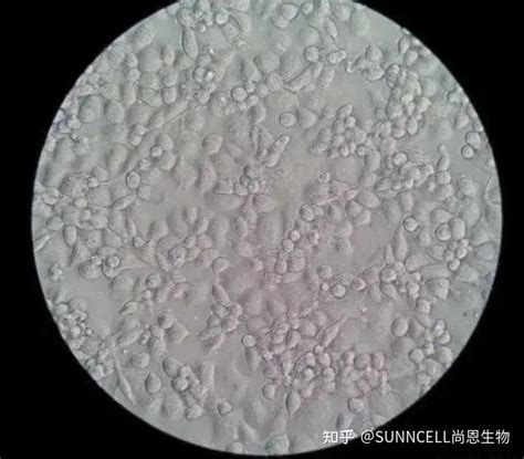 Thp 1（人单核细胞白血病细胞）如何诱导分化 知乎