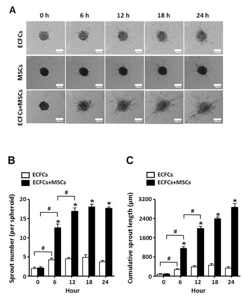 Three Dimensional Angiogenesis Assay System Using Co Culture Spheroids