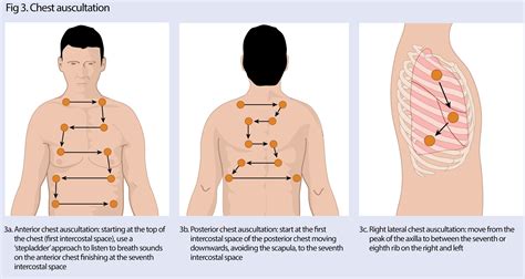 How To Carry Out A Respiratory Assessment In Advanced Practice