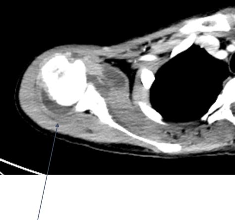 Radiology Manipal Hospital