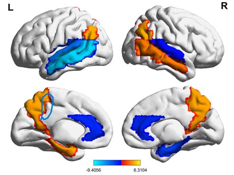How To Remove The Edge Of A Cluster In The Brainnet Viewer The R Fmri Network
