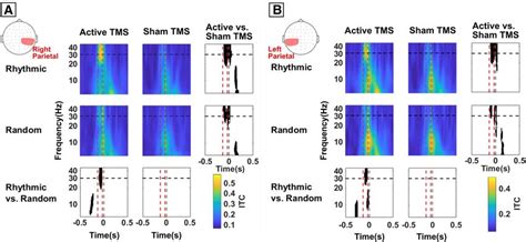 Causal Modulation Of Right Hemisphere Fronto Parietal Phase Synchrony With Transcranial Magnetic