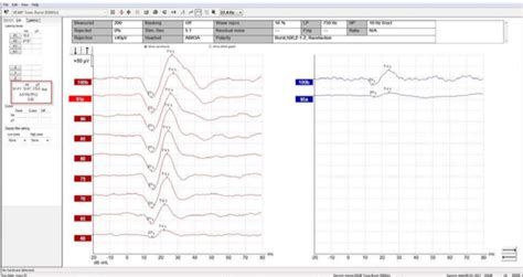 Cvemp Testing With Eclipse