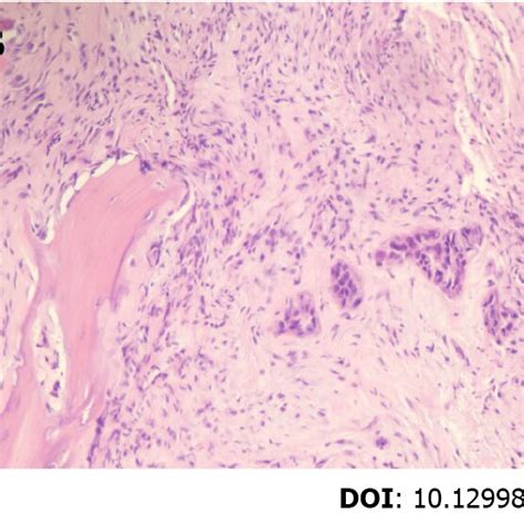 Histopathological Examination A Hematoxylin Eosin Stained L4