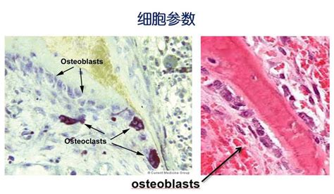 骨形态计量学分析案例 第2页