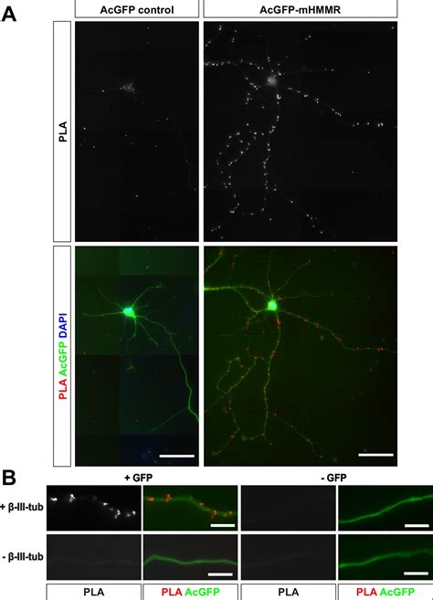 Figures And Data In The Non Mitotic Role Of Hmmr In Regulating The Localization Of Tpx2 And The