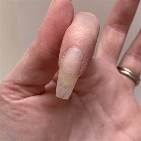 Lifting A Hooked Nail Rebecca Orme Nail Pro