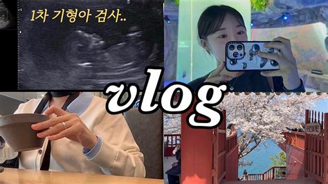 Vlog 1차 기형아 니프티 검사 태교여행 시작 13주차 임신 일상 브이로그 Youtube