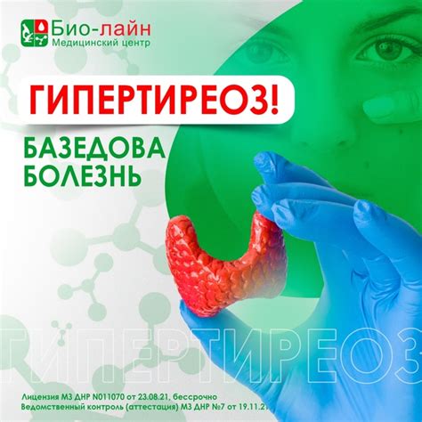 Гипертиреоз Базедова болезнь Базедова болезнь на сегодняшний день считается наиболее
