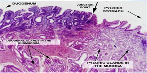 Pectinate Line Histology
