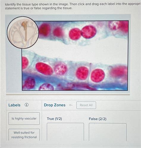 Solved Identify The Tissue Type Shown In The Image Then