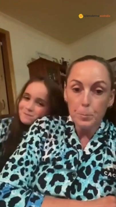 Scleroderma Australia On Linkedin Sclerodermaawareness Strengthinadversity Autoimmunewarrior…