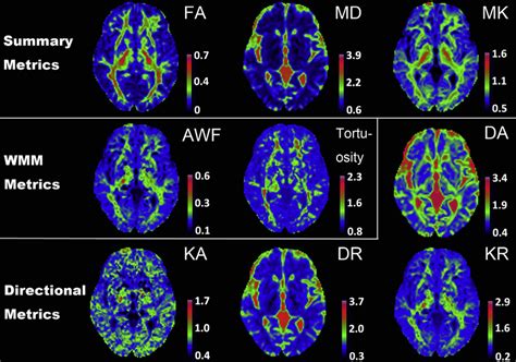 Example Parametric Maps Of Summary White Matter Model Wmm And
