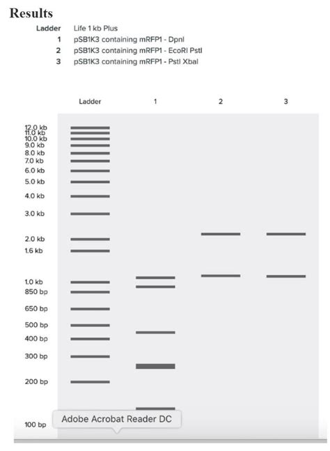 Exercise 5 Diagnostic Restriction Analysis Of Plasmid DNA