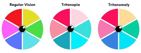 Types Of Color Blindness