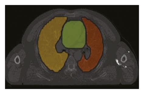 An Improved Mask R‐cnn Model For Multiorgan Segmentation Shu 2020 Mathematical Problems In