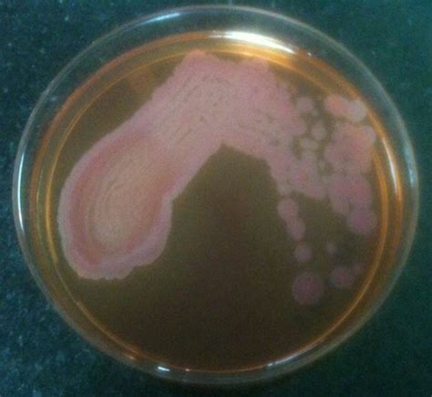 Bacillus Cereus Growth In Macconkey Agar Plate Download Scientific