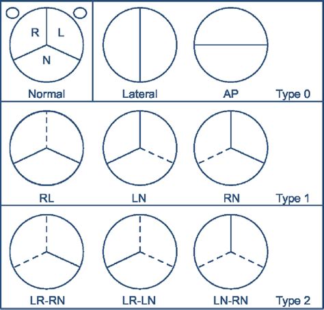 Sievers Classification Applied On Echocardiography Top View Type