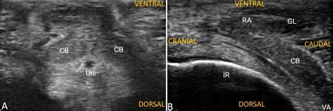 JLE Sexologies Coital Positions And Clitoral Blood Flow A Biomechanical And Sonographic